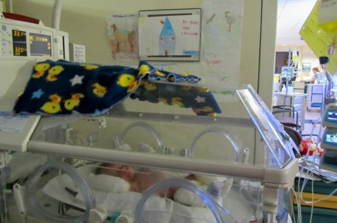 Help Save Easton- baby battling Epidermolysis Bullosa- EB | Indiegogo