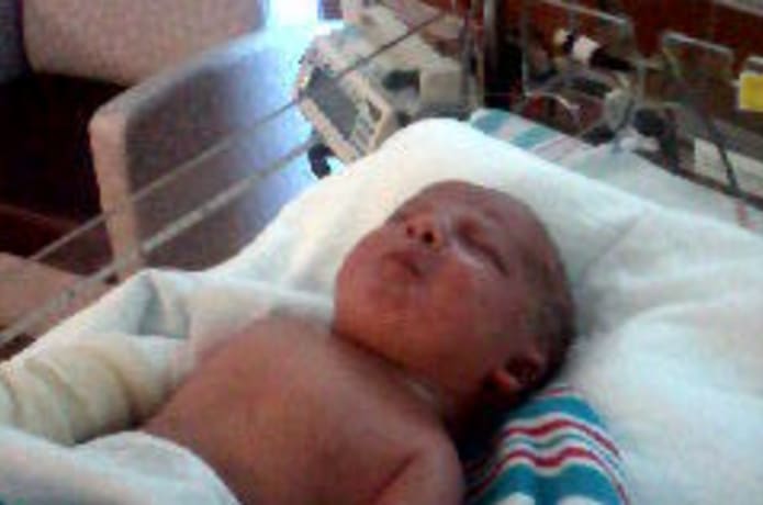 Help Baby Liam who has been battling Epidermolysis Bullosa also known ...