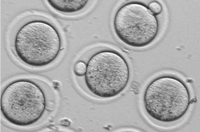 Develop Pregmama's therapy to prevent miscarriage, infertility & birth ...