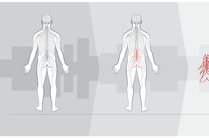 ThinkBody: Anatomy of a Pattern | Indiegogo